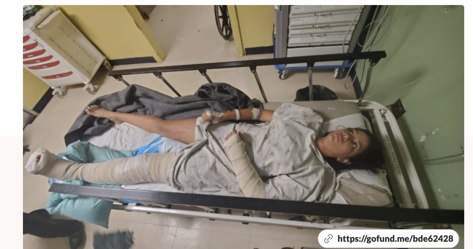 Woman injured in accident on May 3 needs urgent assistance - Antigua ...